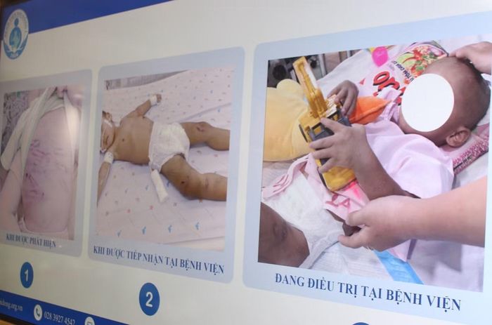 Rơi nước mắt nghe bé trai 2 tuổi bị bạo hành khóc gọi mẹ mỗi đêm - Báo ...